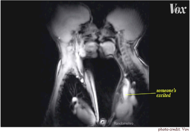 Sex Inside An Mri Machine